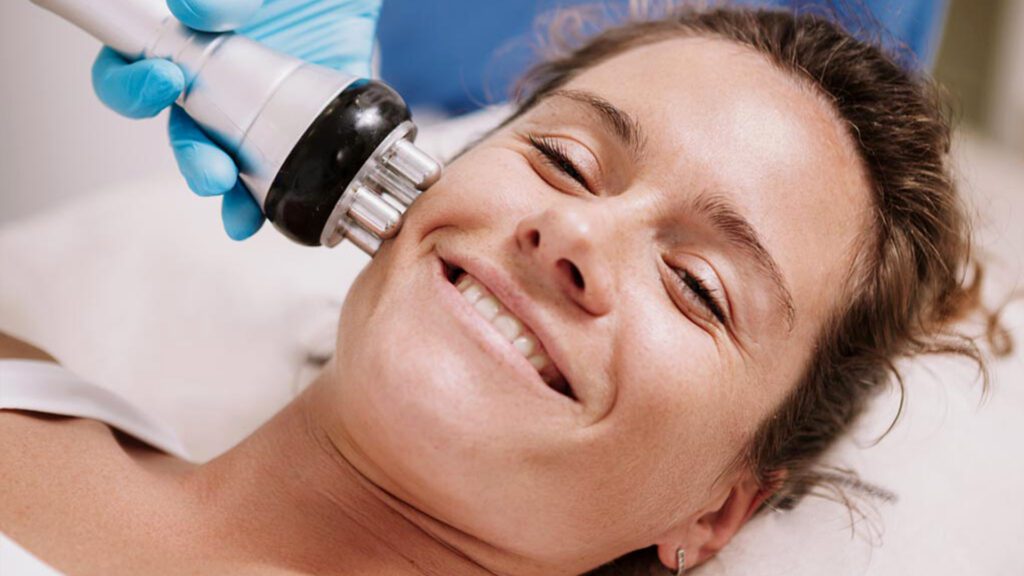 RF Skin Tightening (face only) | Facefit